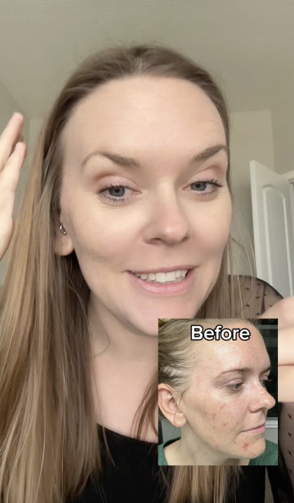 Best Probiotic Brand For Psoriasis · GitHub